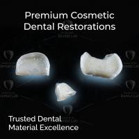 China Natural Composite Inlays And Onlays Ceramic Crown Dental Inlay Onlay Biocompatibility for sale