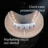 China Non Prep Diagnostic Wax Up For Veneers Rehab Full Mouth Wax Up for sale