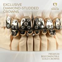 China High Biocompatibility Full Cast Metal Crown Yellow Gold With Diamonds for sale