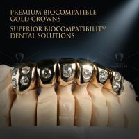 China High Biocompatibility Full Cast Metal Crown Yellow Gold With Diamonds for sale