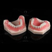 China CAD CAM 3D Printed Denture Biocompatible Acrylic Partial Denture for sale