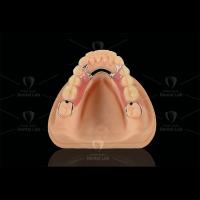 China Biocompatible Printed Partial Framework Co-Cr & Acrylic Partial Denture for sale