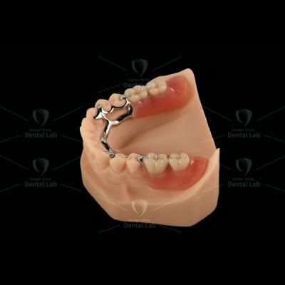 China Lightweight Cobalt Chrome Partial Denture Framework Clasp Flexible Acrylic Partial Denture for sale