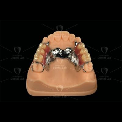 China Medical Co-Cr Metal Framework Partial Color Clasp Acrylic Partial Denture for sale