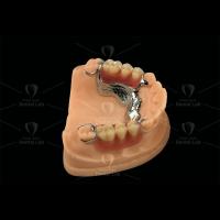 China Medical Co-Cr Metal Framework Partial Color Clasp Acrylic Partial Denture for sale