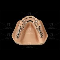China Co-Cr Partial Denture Framework Design With 3D Printing Technology for sale