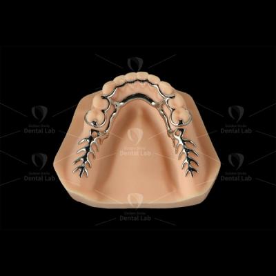 China Co-Cr Partial Denture Framework Design With 3D Printing Technology for sale