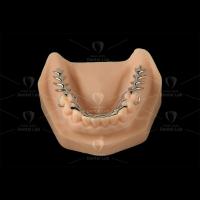 China Co-Cr Partial Denture Framework Design With 3D Printing Technology for sale