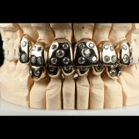 China High Biocompatibility Full Cast Metal Crown Yellow Gold With Diamonds for sale