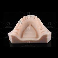 China 74% Yellow Gold Crown PFM High Noble Porcelain Fused To Metal Crown for sale