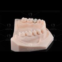 China 74% Yellow Gold Crown PFM High Noble Porcelain Fused To Metal Crown for sale