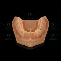 China Yellow Gold 62% Full Cast Crown Saliva And Acids Resistant Gold Crown Implant for sale