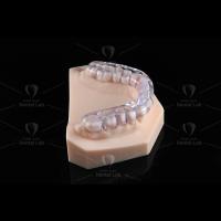 China Hard Type Occlusal Splint 3D Printed Dental Occlusal Guard Precision Fit for sale
