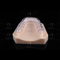 China Hard Type Occlusal Splint 3D Printed Dental Occlusal Guard Precision Fit for sale