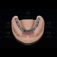China Medical Milled Titanium Bar Dental CAD CAM Titanium Bar For Dental Implants for sale