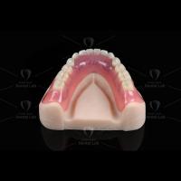 China Dental Implant Bar Titanium CAD CAM With Teeth Shape Screw Included for sale