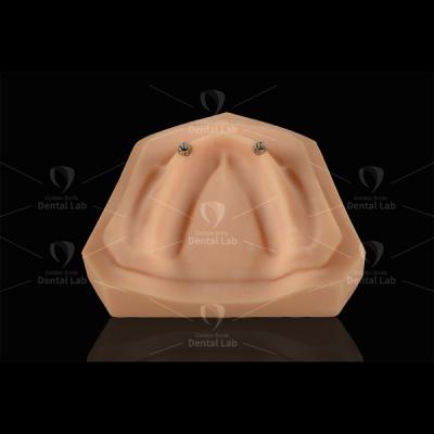 China Root Preservation Dental Implant Parts Metal Protection Cap With Post for sale
