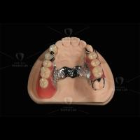 China Milling Reciprocal Arm Precision Attachment Reciprocal Clasp for sale