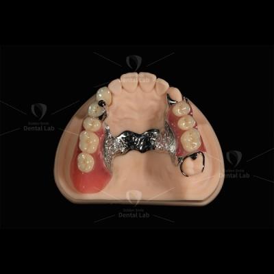 China Milling Reciprocal Arm Precision Attachment Reciprocal Clasp for sale