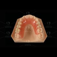 China Natural Look Removable Dentures Acrylic Partial Denture Y Clasp + Wire Clasp for sale