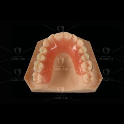 China Natural Look Removable Dentures Acrylic Partial Denture Y Clasp + Wire Clasp for sale