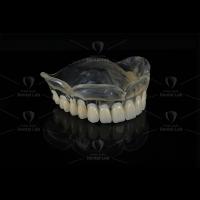 China Vertex Clear Flexible Denture Transparent Removable Partial Denture for sale