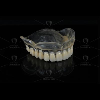 China Vertex Clear Flexible Denture Transparent Removable Partial Denture for sale