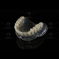 China Vertex Clear Flexible Denture Transparent Removable Partial Denture for sale
