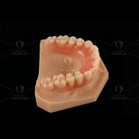 China Medical Grade Valplast Partial Denture Valplast Dental Lab Metal Free for sale
