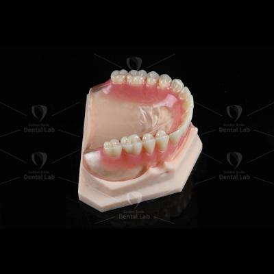 China Lightweight Pink Clear Flexible Denture Vertex Flexible Partials for sale
