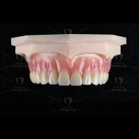 China Lightweight Pink Clear Flexible Denture Vertex Flexible Partials for sale