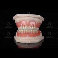 China Valplast Tooth Full Denture Aesthetics Removable Dentures Impact Resistant for sale