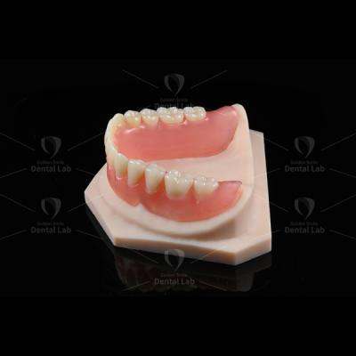 China Valplast Tooth Full Denture Aesthetics Removable Dentures Impact Resistant for sale