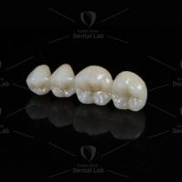 China Cut Back Layered Zirconia Hybrid Monolithic Veneer 3D Multilayer Zirconia for sale