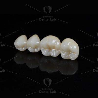 China Cut Back Layered Zirconia Hybrid Monolithic Veneer 3D Multilayer Zirconia for sale