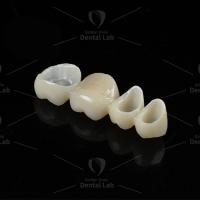 China Cut Back Layered Zirconia Hybrid Monolithic Veneer 3D Multilayer Zirconia for sale