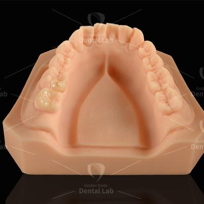 China High Strength Zirconia Inlay Onlay Zirconia Restorations CAD / CAM Digital Milling for sale