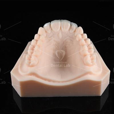 China Aesthetic Dental Zirconia Veneer High Translucency Zirconium Oxide Dental for sale