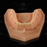 China E Max Bridge Emax Laminate Veneers Lithium Disilicate Glass Ceramic Material for sale