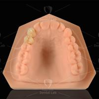 China E Max Bridge Emax Laminate Veneers Lithium Disilicate Glass Ceramic Material for sale