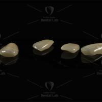 China Translucency Emax Lithium Disilicate Veneers Ceramic Layered Emax Veneers for sale
