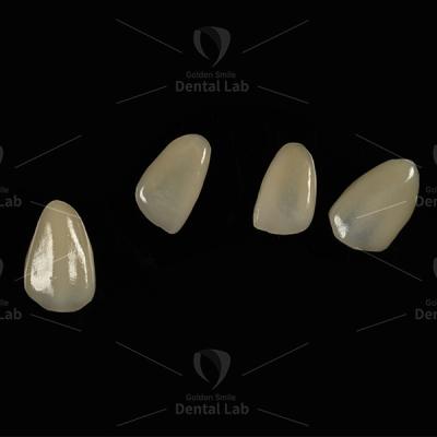 China Translucency Emax Lithium Disilicate Veneers Ceramic Layered Emax Veneers for sale