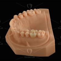 China Monolithic Full EMax Crown Lithium Disilicate Crown E Max Natural Translucency for sale