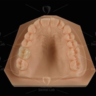 China Monolithic Full EMax Crown Lithium Disilicate Crown E Max Natural Translucency for sale