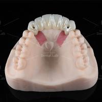China Multilayered Full Zirconia Bridge Screw Retained Bridge Customizable for sale