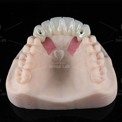 China Multilayered Full Zirconia Bridge Screw Retained Bridge Customizable for sale