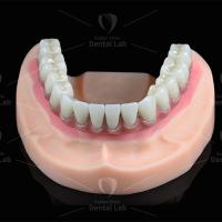 China Implant PFM Crown Co-Cr Screw Retained Dental Crown And Bridge for sale