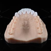 China Dental Crown Wax Up Preparation Single Tooth Implants Diagnostic Waxup for sale