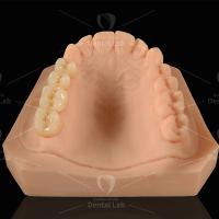 China CAD/CAM Dental Zirconia Bridge Medical Grade Layered Zirconia Bridge for sale