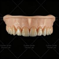 China Aesthetic Zirconia  Dental Bridge High Translucency  CAD CAM Zirconia Crown for sale